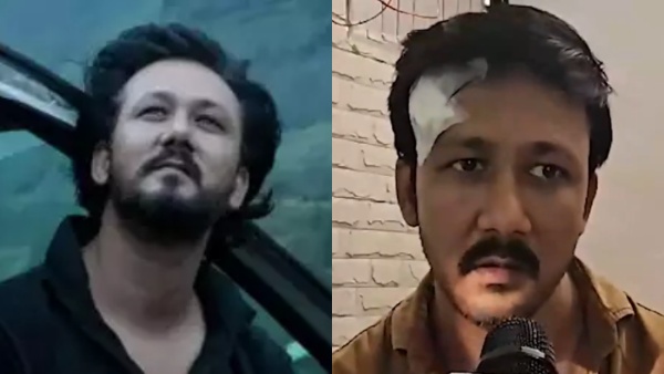 Crime Patrol Actor Raghav Tiwari Claims Action Director Son Attacked ...