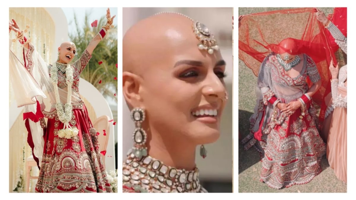 bald bride shocking everyone groom reaction meet Nihar Sachdeva and ...