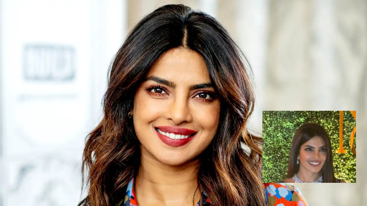 Priyanka Chopra's lips surgery disfigured? fans also got shocked after ...
