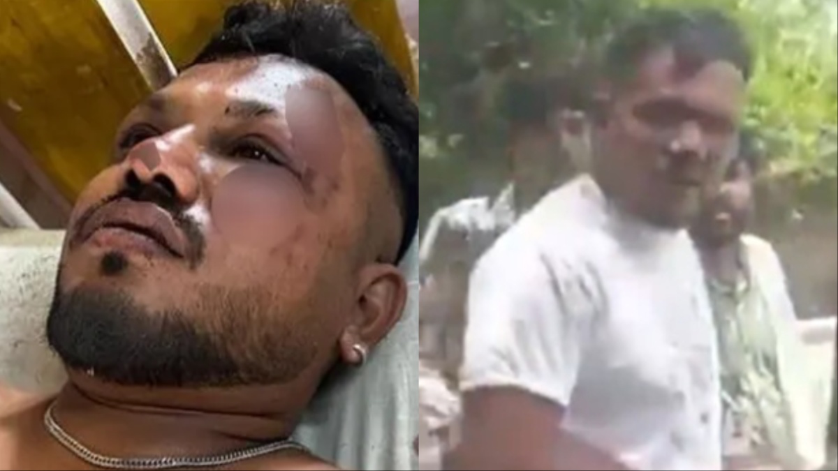 Ahmedabad Plane Crash Passenger Vishwas Kumar Miraculously Survives ...