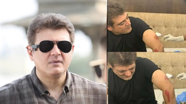 Ajith's Doctor Reveals He Was Close To Suffering Paralysis, Says The ...