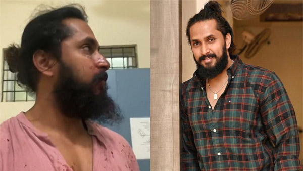 Kannada Actor Chetan Chandra Faces Brutal Attack Near Bengaluru, Sparks ...